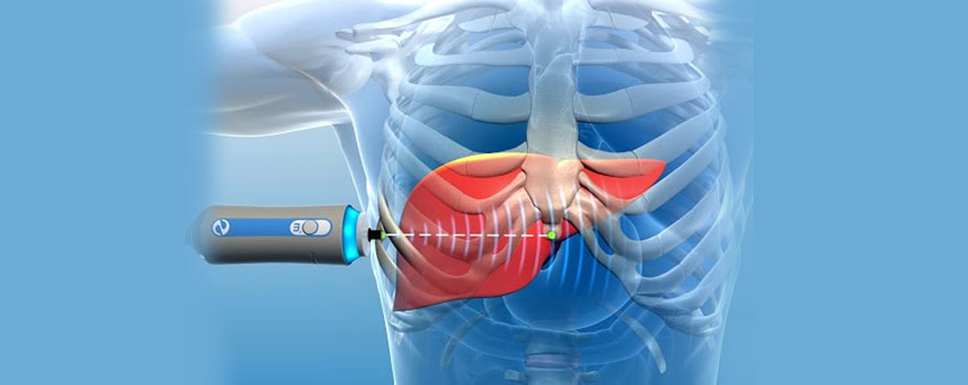 Dr Nikhil Bhangale | Gastroentrologist